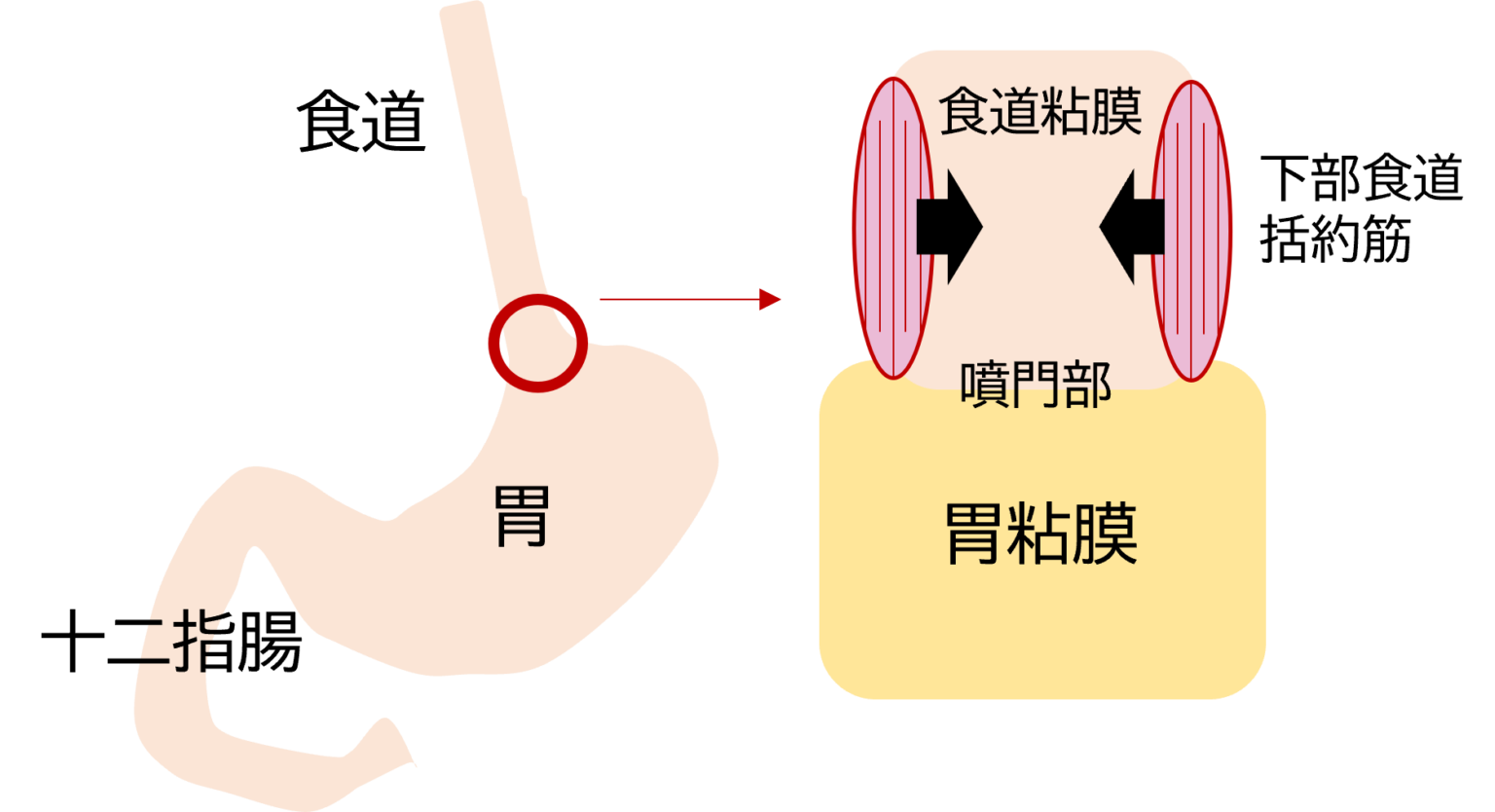 胃食道逆流症 Gerd ｜元町・中華街の内科「ソージュ山下町内科クリニック」 0803